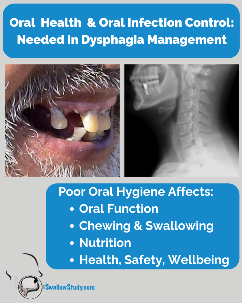 Blogs About Speech-Language Pathology & Dysphagia Services